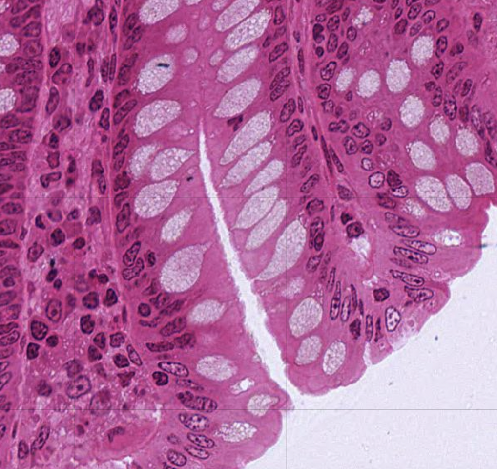 Cells, Organelles: Basic and Acid Stains